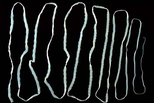 Tapeworms | nidirect